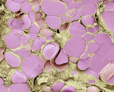 Thyroid Gland Sem Stock Image F0031009 Science Photo Library