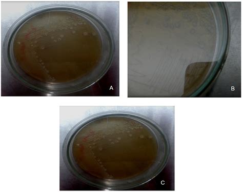 Enhancement Of Alkaline Production Of Xylanase From Bacillus Sp Through A Statistical Approach