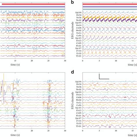 Pdf A Dataset Of Neonatal Eeg Recordings With Seizure Annotations