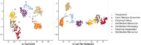 Self Knowledge Distillation For Surgical Phase Recognition Paper And Code Catalyzex
