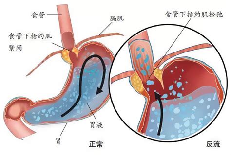 反流性食管炎模型 【动物造模】 知乎