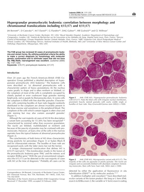 Acute Promyelocytic Leukemia Microgranular Variant