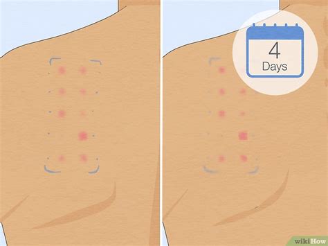 7 Simple Steps For Patch Testing A New Cosmetic Or Skincare Product