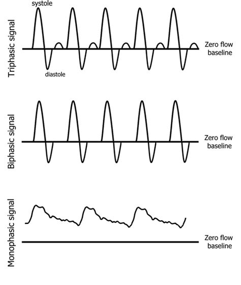 Measurement Of Ankle Pressures Assessment Doppler Waveforms And Calculation Of The Ankle