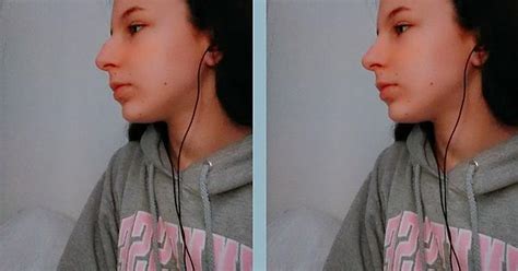 Rhino Sample Left Before Right After Album On Imgur