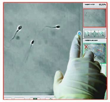 Sperm Selection For ICSI Using RI ICSI Taken From Download Scientific Diagram