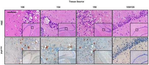 Sponorm Degeneration And Prp Cwd In The Hippocampus Of Inoculated Download Scientific