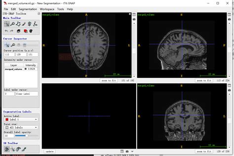 【3d 图像分割】基于 Pytorch 的 3d 图像分割9（patch 的 Crop 和 Merge 操作）病理学图像分割成patch滑动的步长 Csdn博客