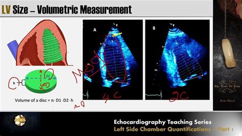 Lecture 4 Left Side Chamber Quantification Part 1 Cardiac Sonography Lecture Sonography