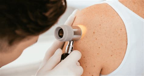 Polype Nasal Définition Symptômes Et Avis De Spécialistes