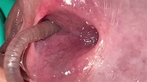 Worm Entering Cock Close Up Worm In Cock Urethra Play With Worm MOTHERLESS COM