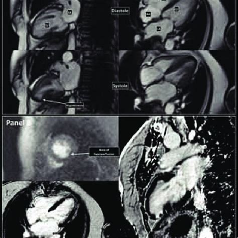 The Intertak Diagnostic Score At Presentation Download Scientific Diagram