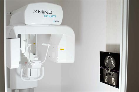 3d Scanner Dental Acteon Trium Clínica Dental Goenea