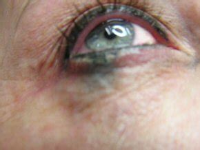 Deadly Eye Makeup And Other Beauty” Aids” Stop Using These Sally