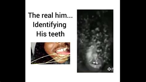 Identifying His Teeth Triviaandthe Real Him Pt2and Xxx Mobile Porno Videos And Movies Iporntv Net