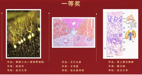 我院师生在全国高等医药院校第二届大学生医学形态学绘图大赛中喜获佳绩 ‍ 包头医学院 基础医学与法学院