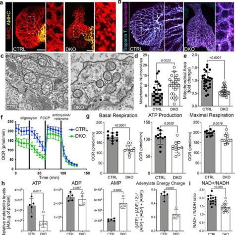 Rbfox Proteins Mediate Sarcomere Assembly And Mitochondrial Download Scientific Diagram