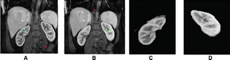 Graph Cut Algorithm For Anatomical Organ Delineation A B Input