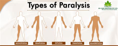 Mississippi Paralysis Association Helping The Disable Become Able