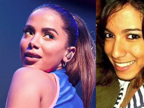 Anitta Antes Da Plastica