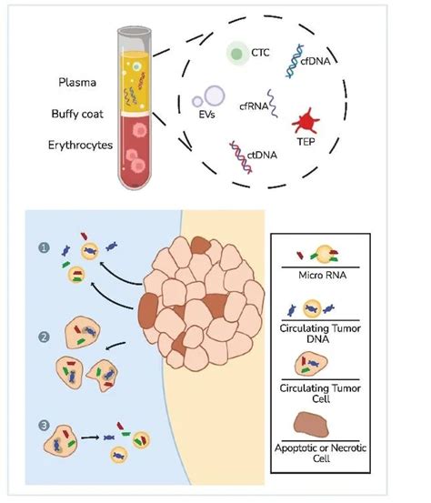 What Are Tumor Markers And Their Role Prepladder