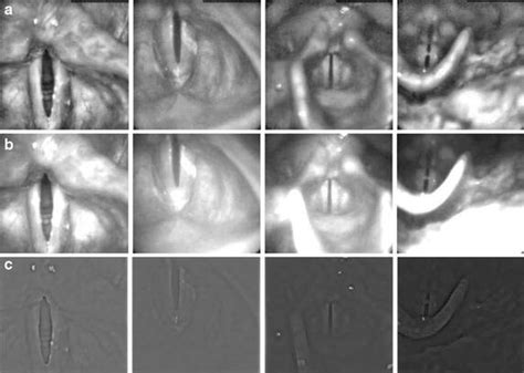 Subjective Evaluation Of The Pre Processing Algorithms A Visual Download Scientific Diagram