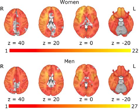 Lesion Overlap Maps For Women And Men Spatial Correlation Between The