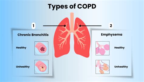 Types Of Copd Chronic Obstructive Pulmonary Disease