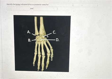 Solved Identify The Bones Indicated This Is A Posterior