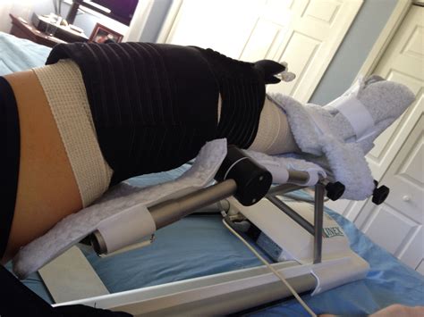 Pin By Cxc On 毕设 Acl Surgery Knee Surgery Cruciate Ligament