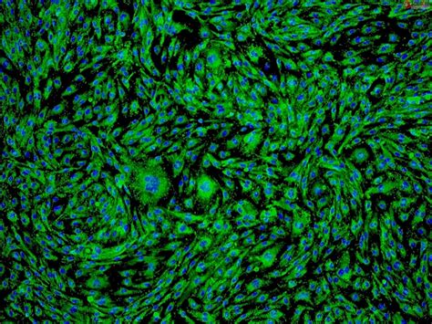 Human Ovarian Microvascular Endothelial Cells