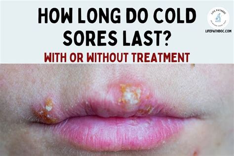How Long Do Cold Sores Last