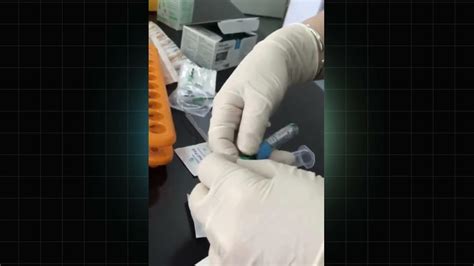 Венийн судаснаас цус авах Youtube