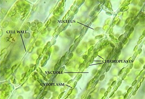 Plant Cell Under Microscope 400x