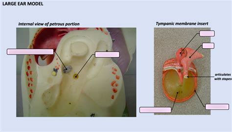 Petrous Portiontympanic Membrane Diagram Quizlet