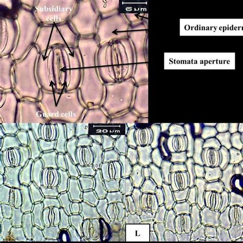 Characters Of Stomata Shape In The Eichhornia Crassipes Download