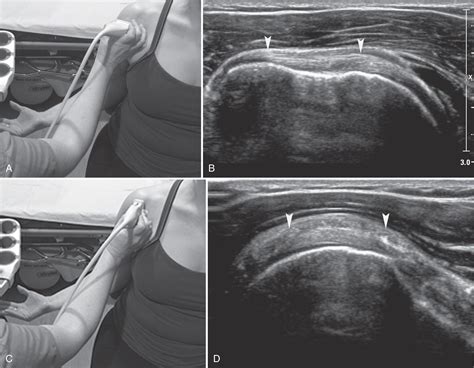 The Shoulder Clinical Tree