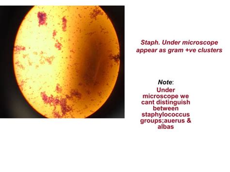 Staphylococcus And Streptococcus Ppt Blood Disorders Diseases And Conditions