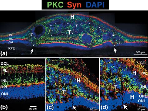 Double Labeling For Synaptic Marker Synaptophysin Red And Rod Bipolar Download Scientific