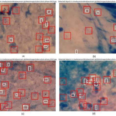 Proposed Deep Learning Architecture For Tuberculosis Detection