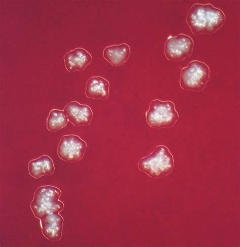 Actinomyces Colony Morphology