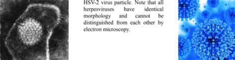 Herpes Simplex Viruses Flashcards Quizlet