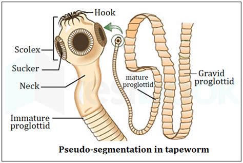 [solved] Body Of Tapeworm Is Said To Be