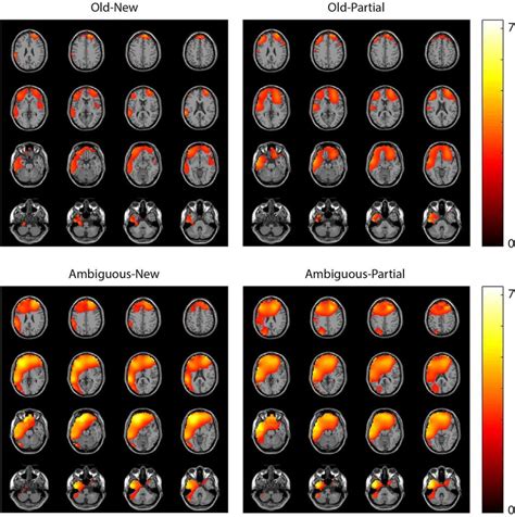 Beamformer Source Localization Of The Pair Wise Beta Effects 10 15