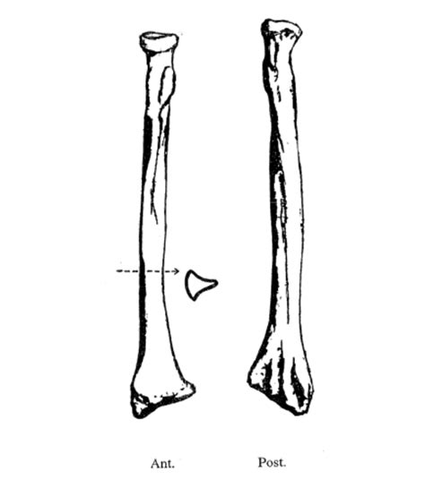 Radius Diagram Quizlet