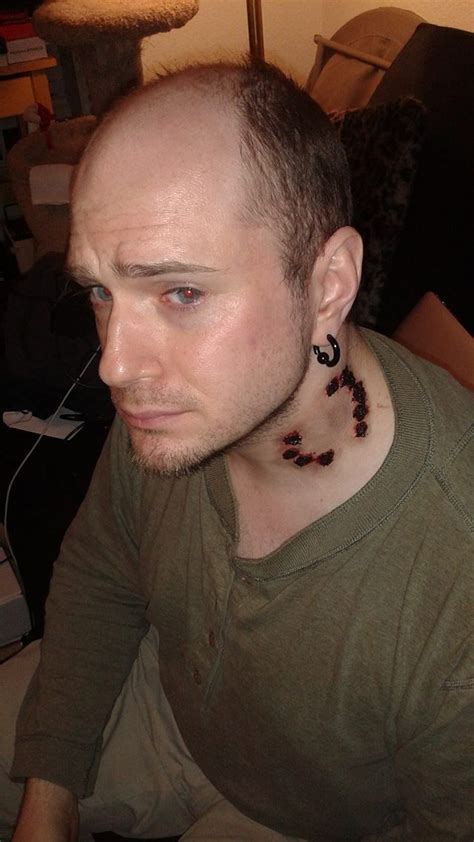 Friend Of Mine Got Bit By A Werewolf Or Something Like That I Dunno