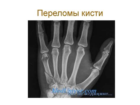 Кости и мышцы верхних конечностей. (Лекция 9) - презентация онлайн