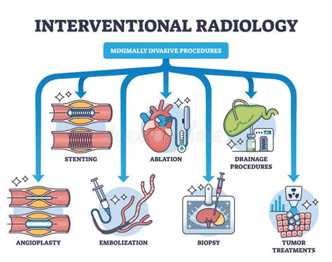Interventional Radiology Logo