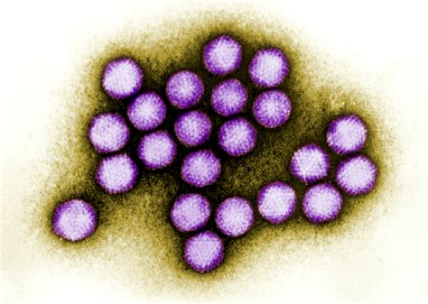 Free Picture Colorized Transmission Electron Micrograph Adenovirus
