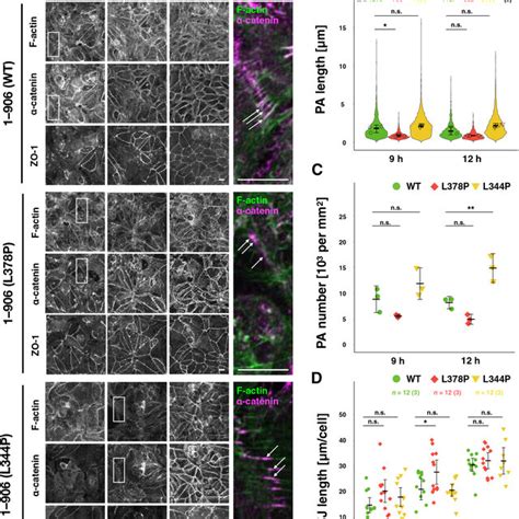 Tension Sensitivity Mutation Of α Catenin Alters Junctional Maturation